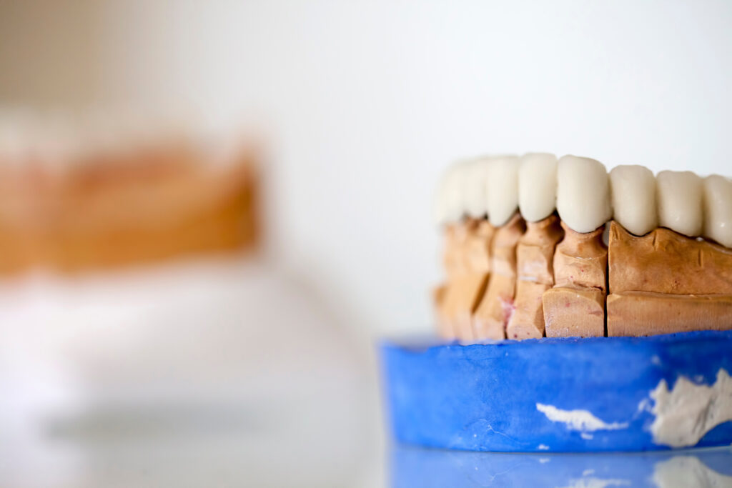 Prothese – Dental Planet